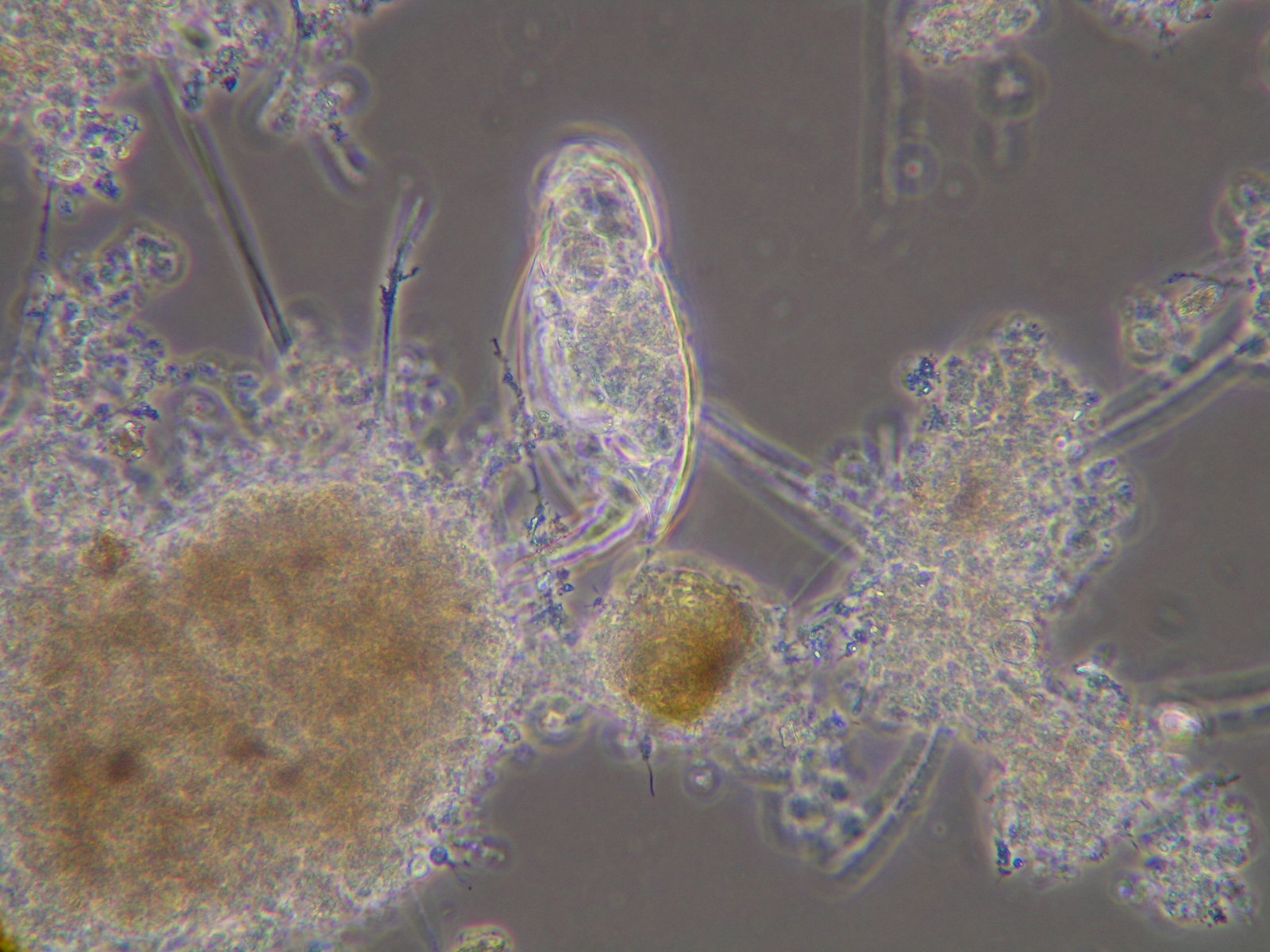 Les spirilles : interprétation, évaluation et numération - La Revue EIN