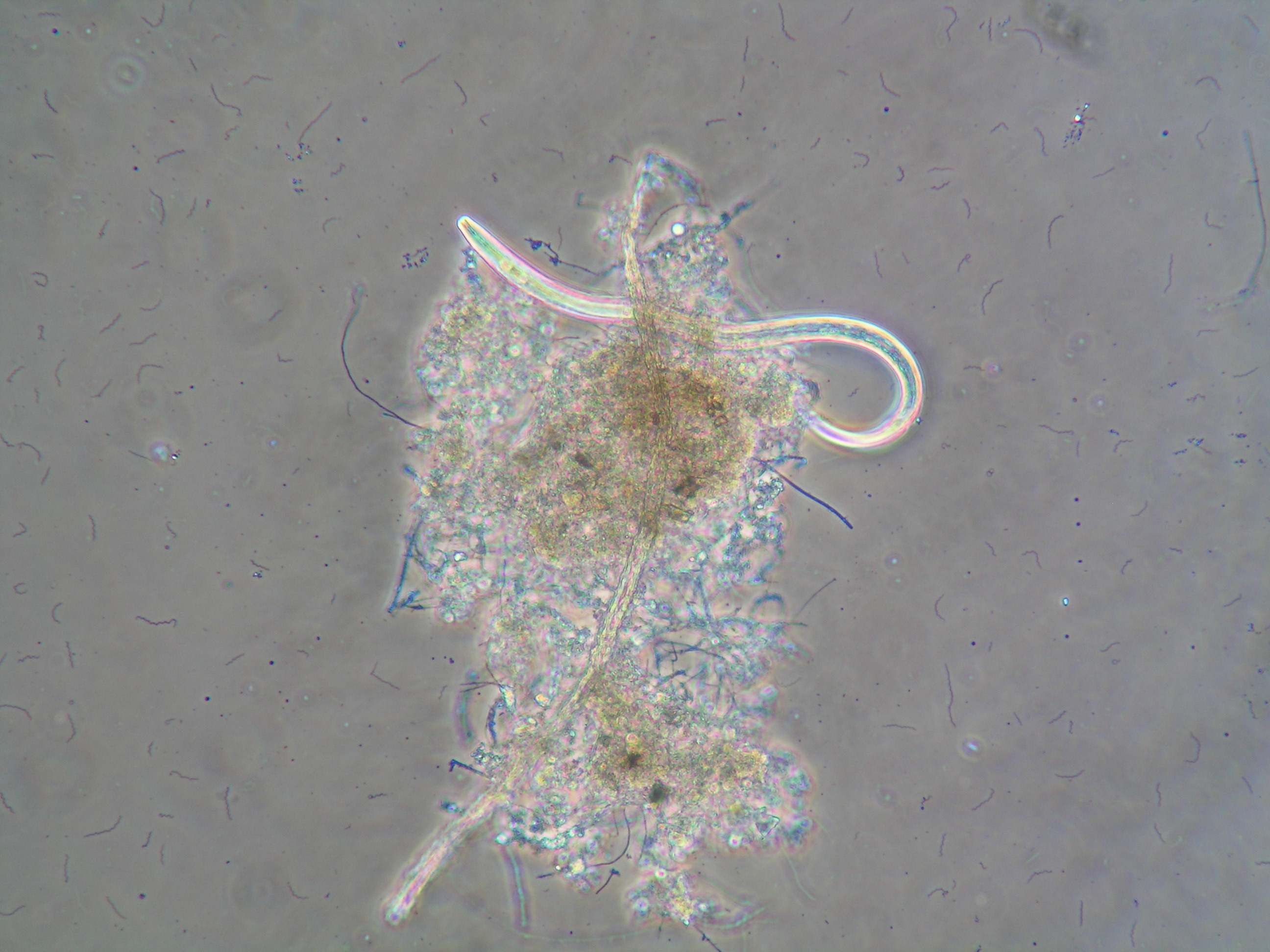 Les spirilles : interprétation, évaluation et numération - La Revue EIN