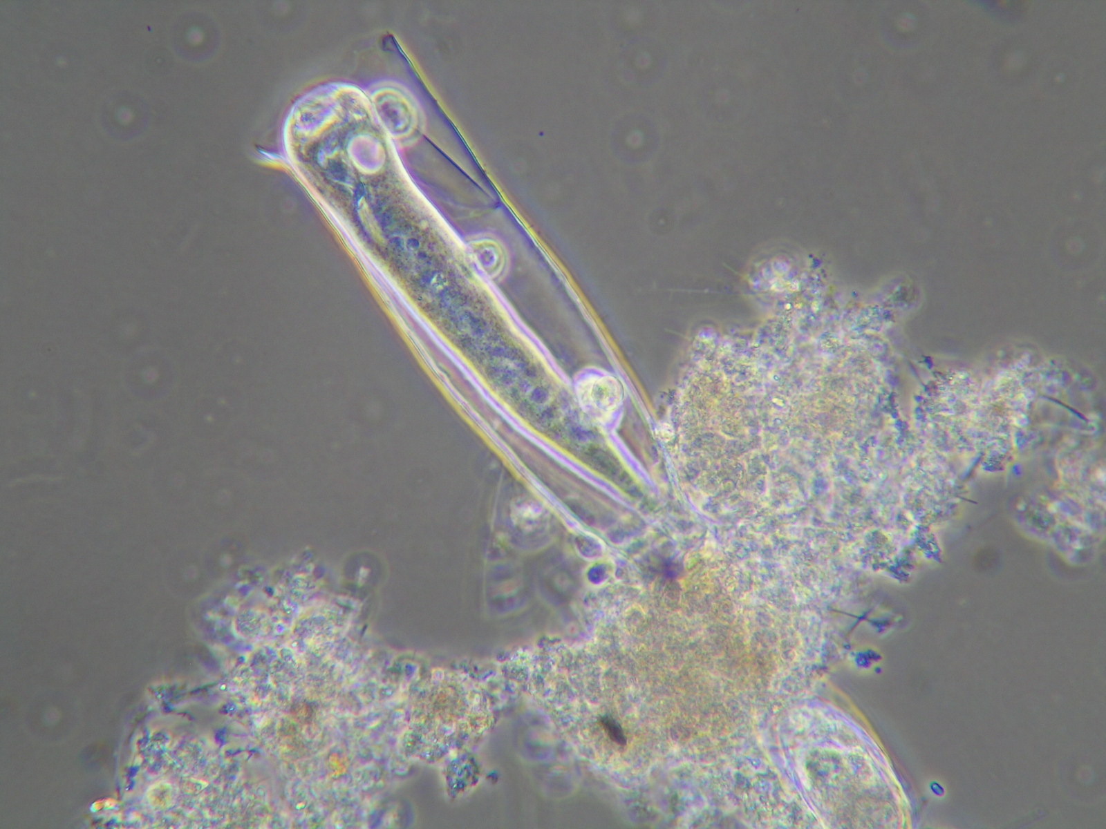 Les spirilles : interprétation, évaluation et numération - La Revue EIN