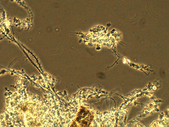 Les spirilles : interprétation, évaluation et numération - La Revue EIN