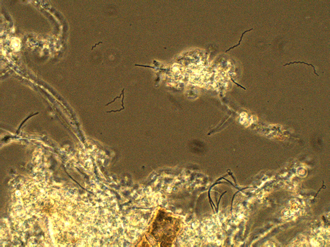 Les spirilles : interprétation, évaluation et numération - La Revue EIN