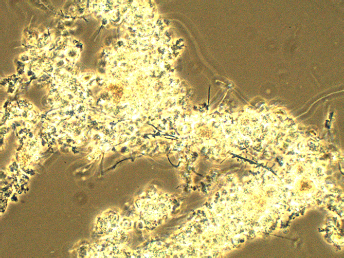 Les spirilles : interprétation, évaluation et numération - La Revue EIN