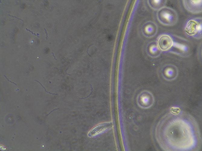 Les spirilles : interprétation, évaluation et numération - La Revue EIN
