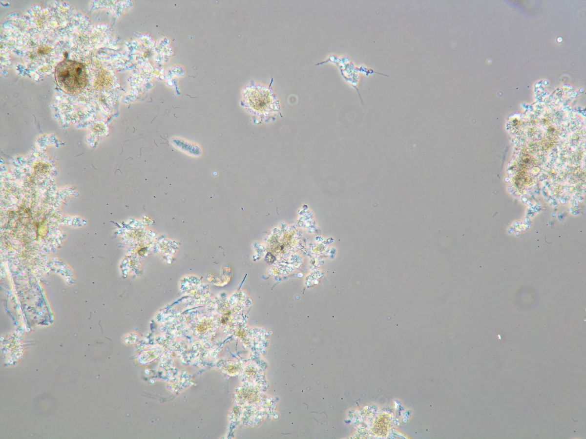 Les spirilles : interprétation, évaluation et numération - La Revue EIN