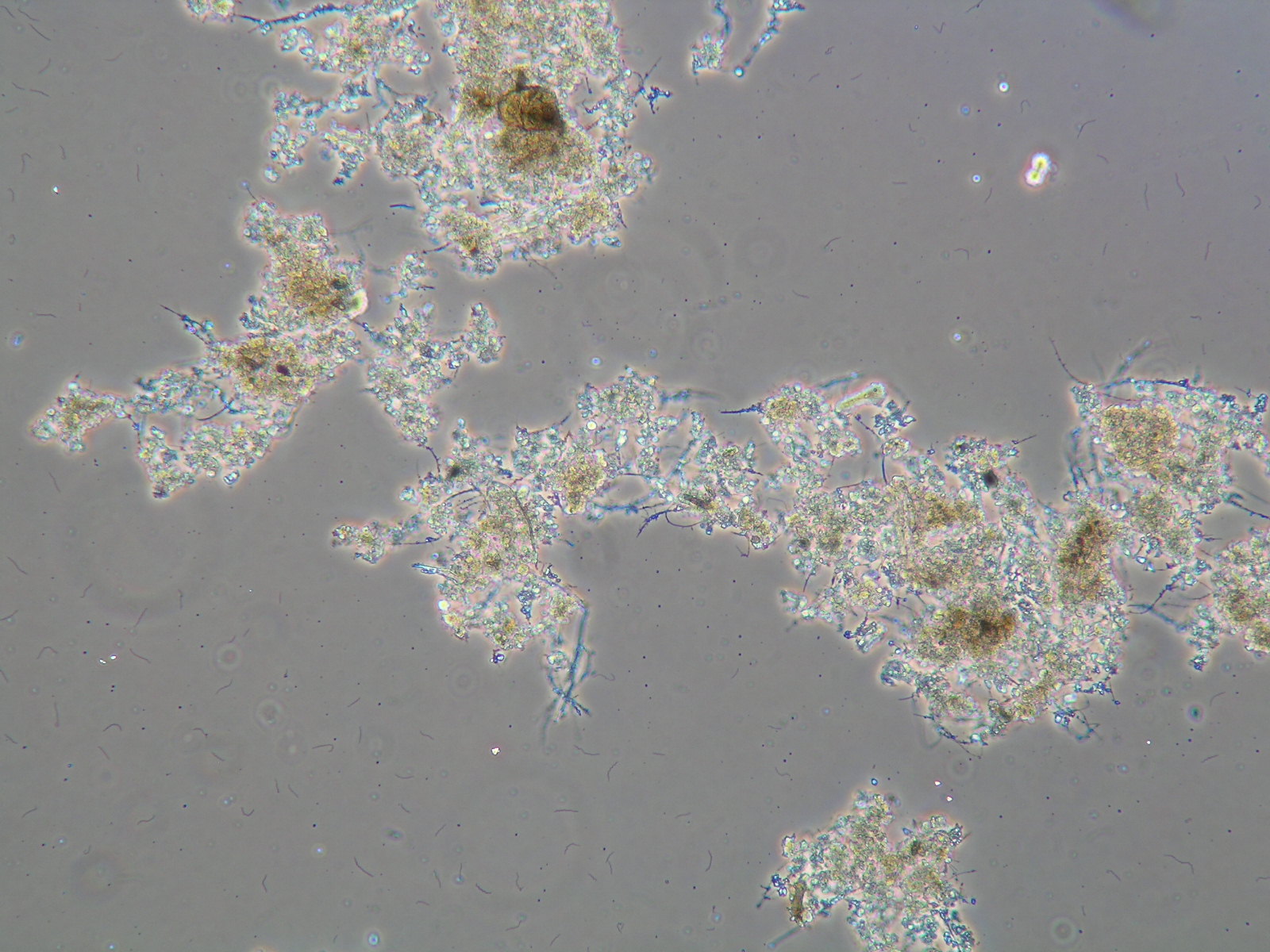 Les spirilles : interprétation, évaluation et numération - La Revue EIN